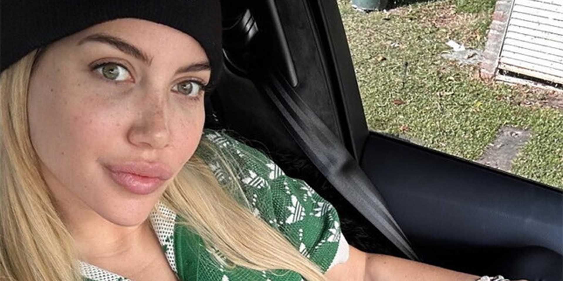 Wanda Nara conferma la malattia: "Sono ancora sotto choc". Foto e video